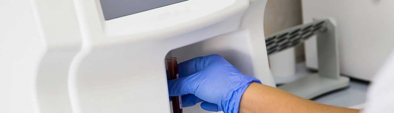 Affordable Blood Cell Counter | L&T Technology Services