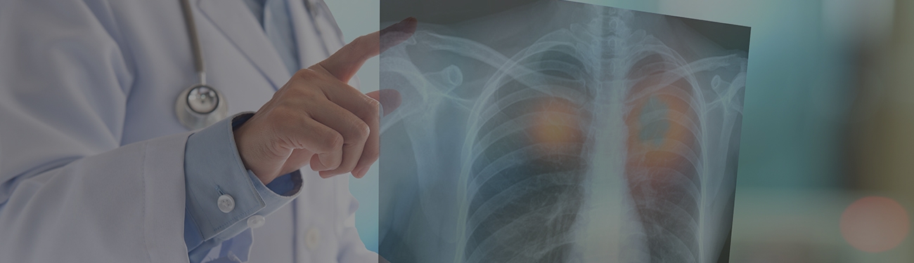 AI for Radiography - Brochure